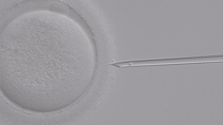 Fécondation ICSI - IMSI Spagne | Barcelona IVF