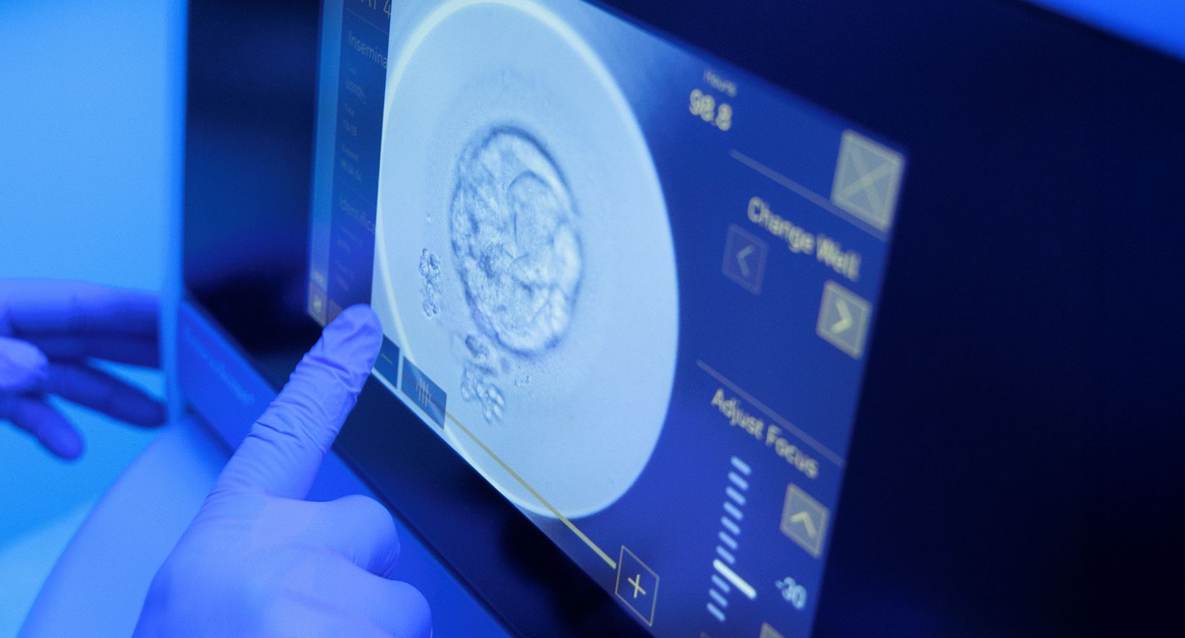 IDAScore and the AI revolution in embryo selection | Barcelona IVF