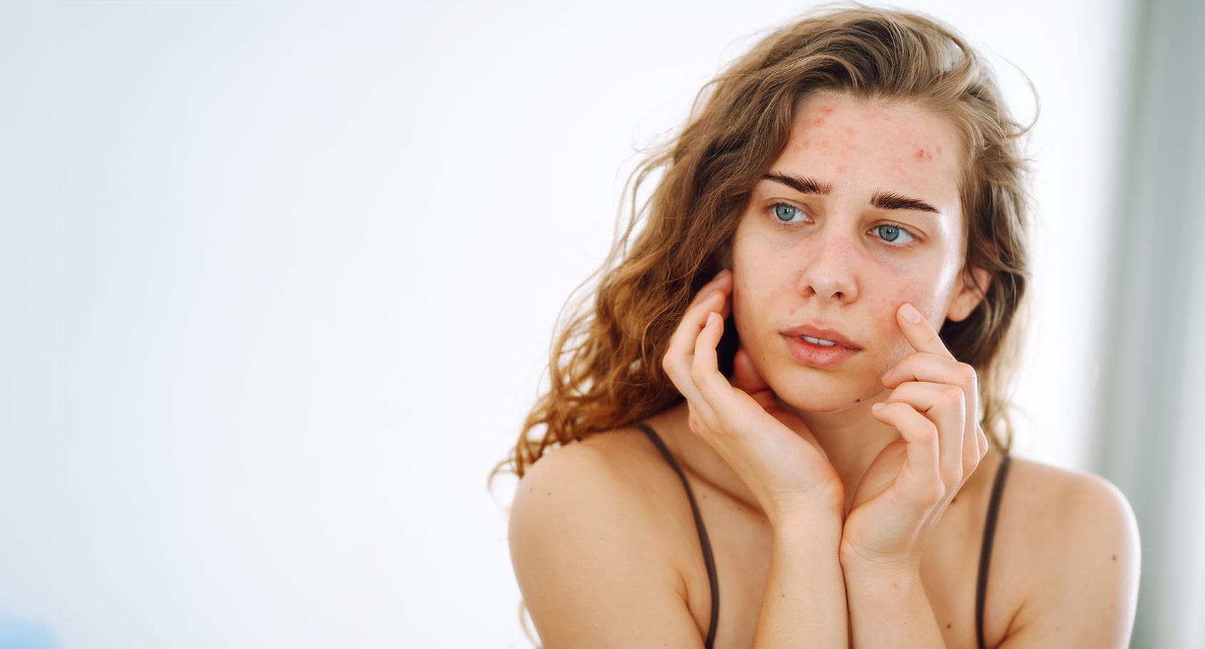 Hyperandrogenism and fertility: symptoms, causes and treatments ...