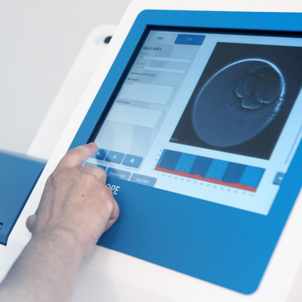 Embryoscope Spain | Barcelona IVF