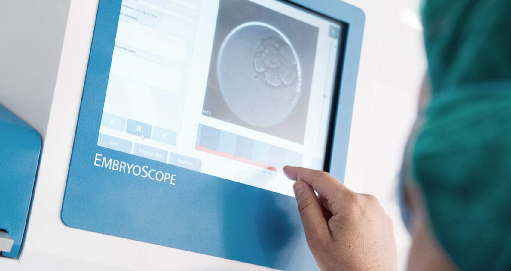 ¿Qué es el EmbryoScope y cómo funciona? | Barcelona IVF