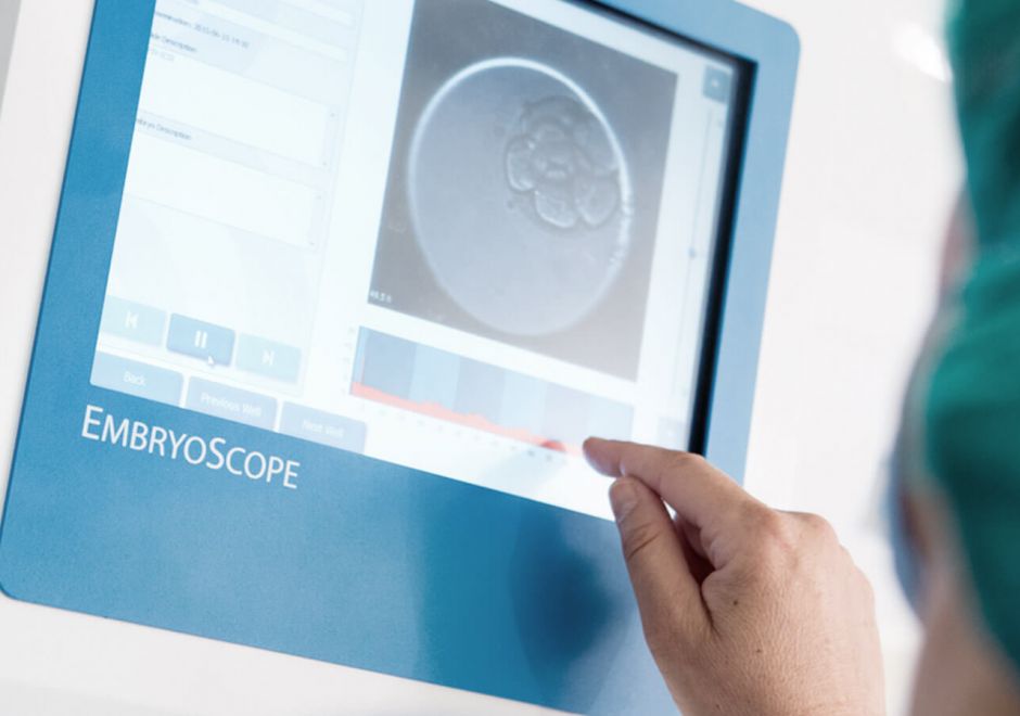 ¿Qué es el Embryoscope o Time Lapse? | Barcelona IVF