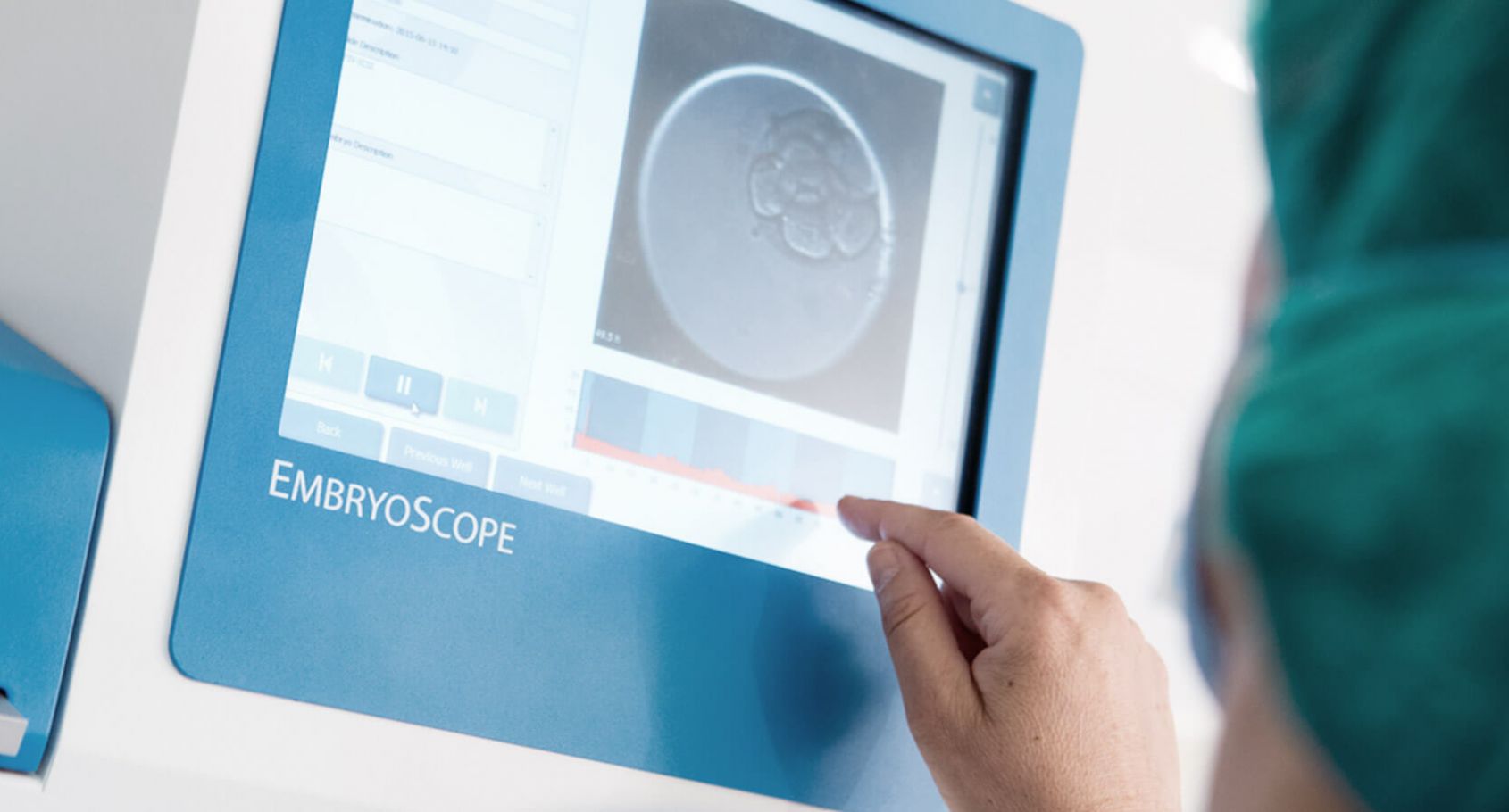 ¿Qué es el EmbryoScope y cómo funciona? | Barcelona IVF