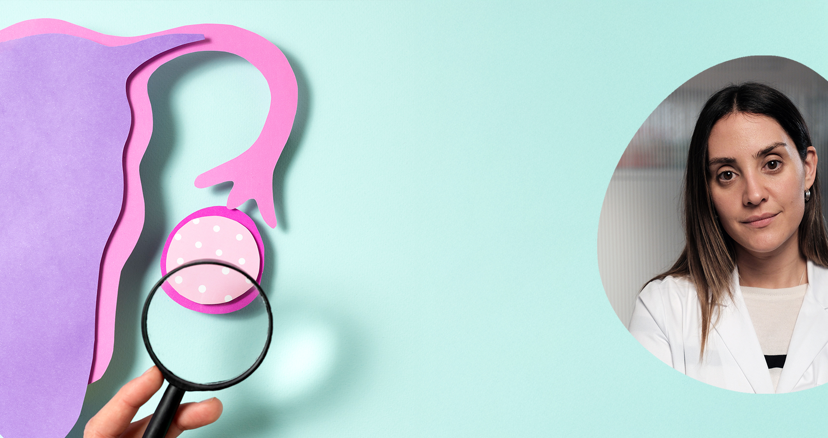 Comprendre le SOP : défis et solutions pour la fertilité | Barcelona IVF
