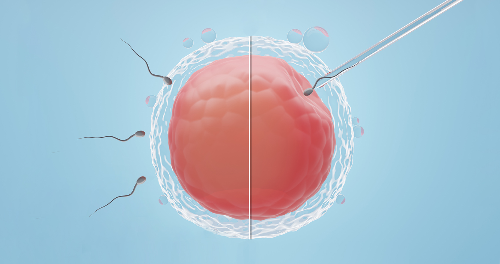Conventional IVF vs ICSI: What are the techniques and how do they ...